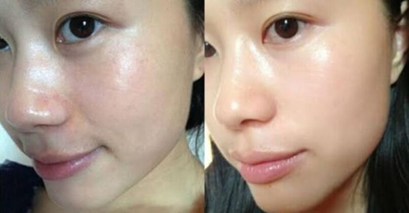 5 Rice Mask Recipes that do work - sharingideas.me